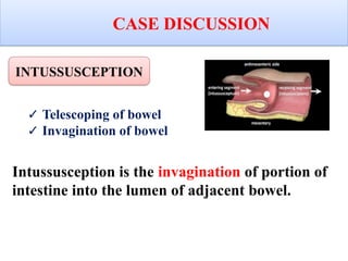 Successful management of intussusception in a cow under double drip ...