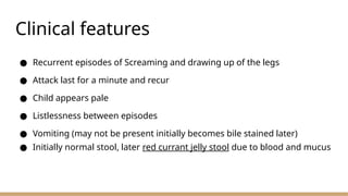 Intussusception - 4th year MBBS GENERAL SURGERY TOPIC | PPTX