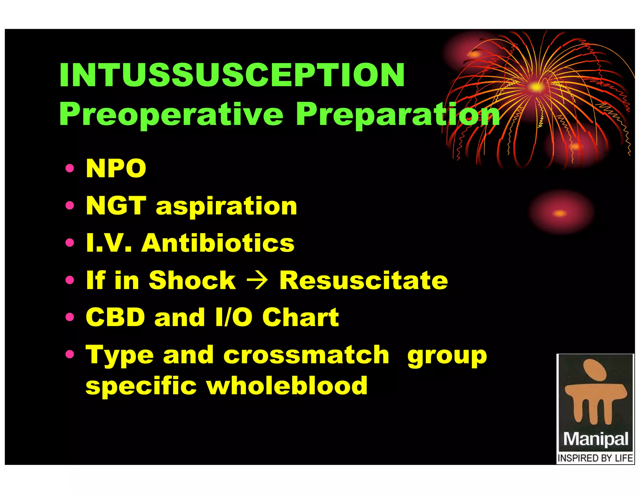 Pediatric Intussusception - An Overview | PDF