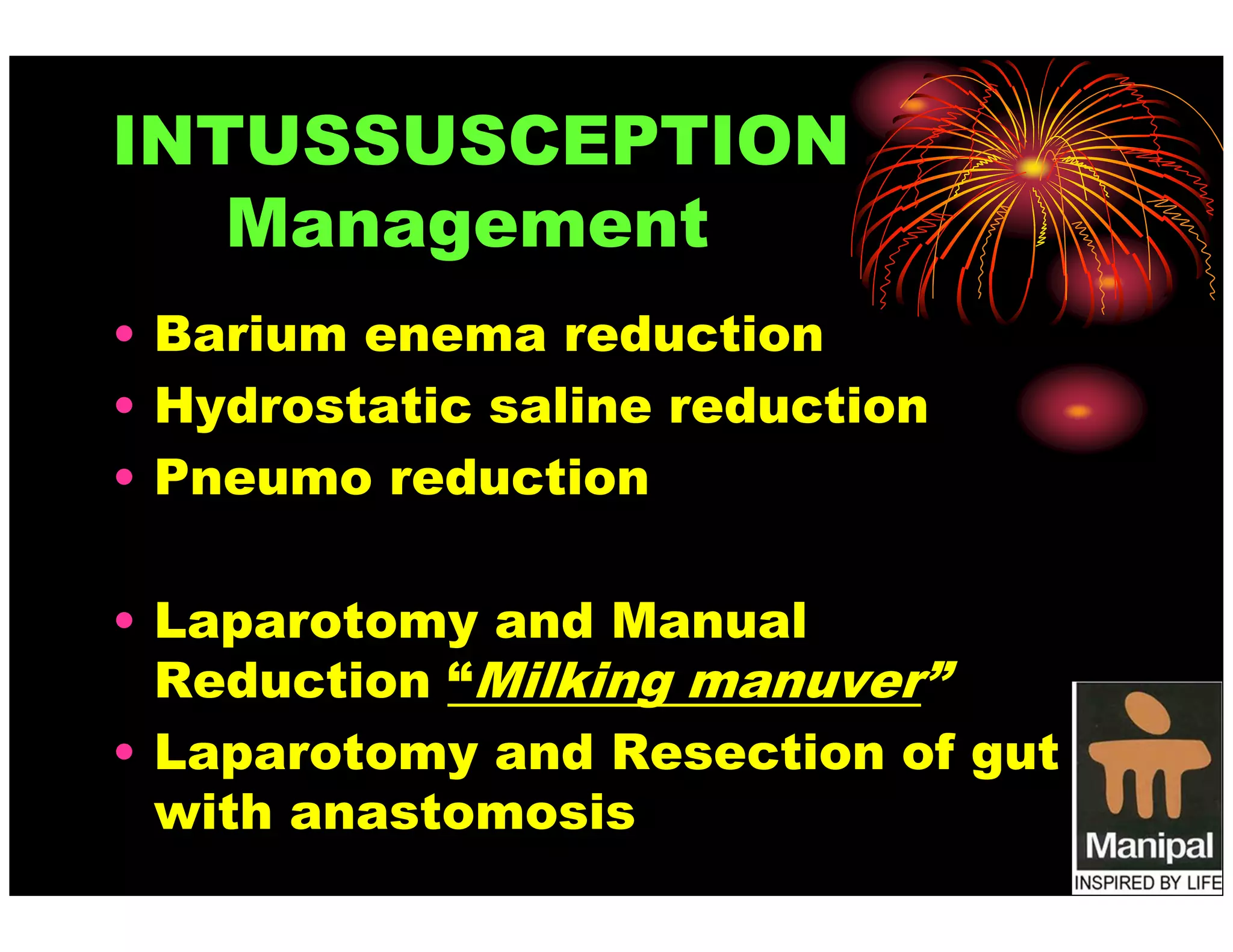 Pediatric Intussusception - An Overview | PDF