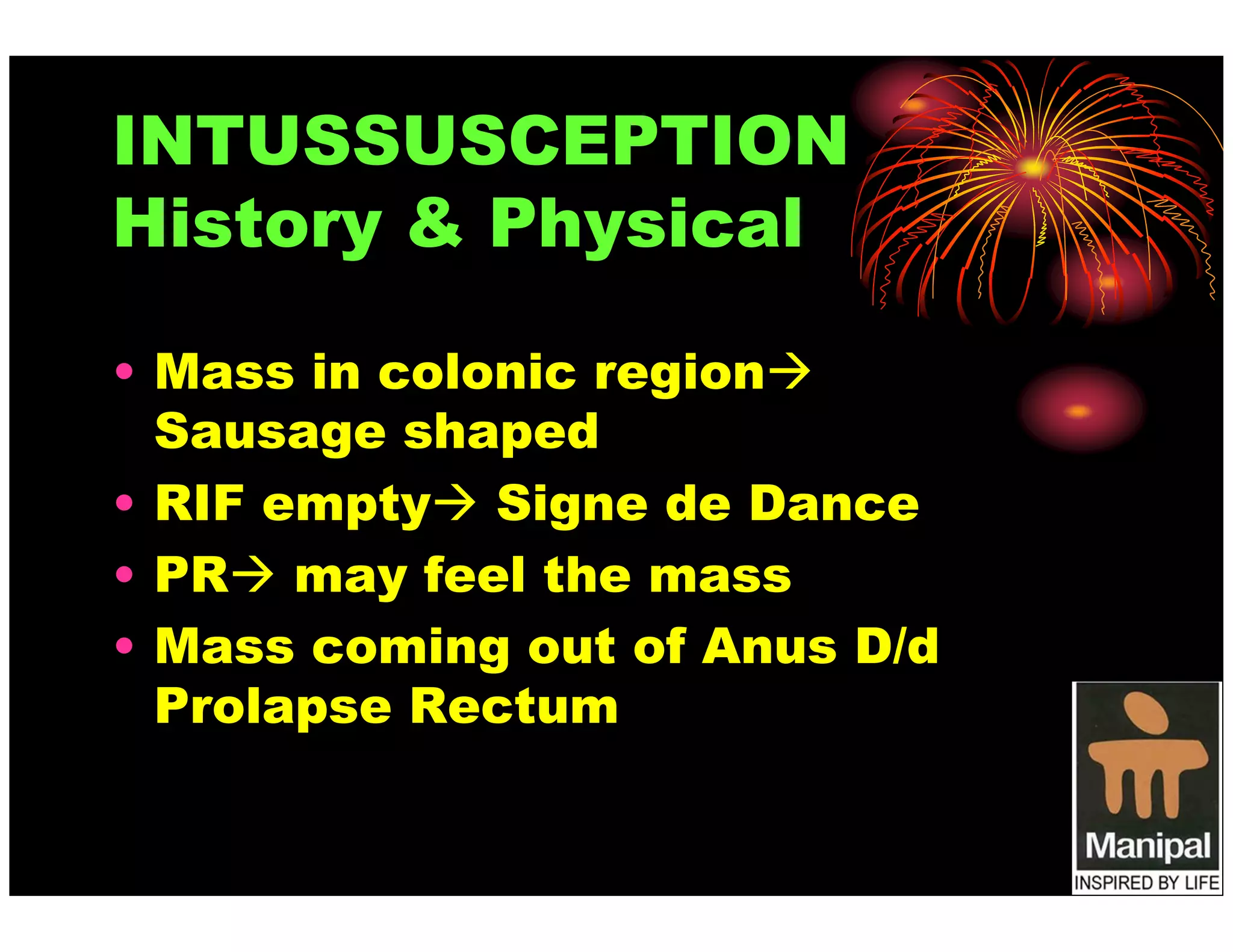 Pediatric Intussusception - An Overview | PDF