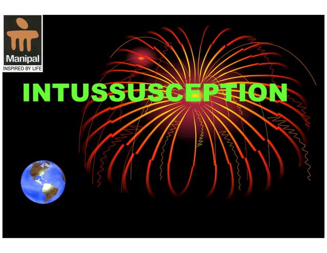 Pediatric Intussusception - An Overview | PDF | Digestive Disorders ...
