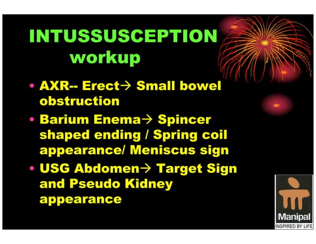 Pediatric Intussusception - An Overview | PDF | Digestive Disorders ...