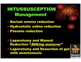 Pediatric Intussusception - An Overview | PDF
