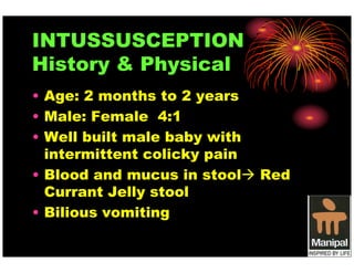 Pediatric Intussusception - An Overview | PDF