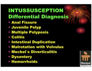 Intussusception In Children