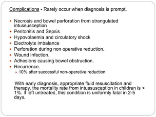 Intussusception (2) | PDF
