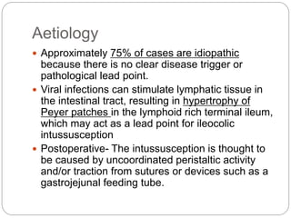 Intussusception (2) | PDF