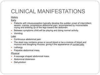Intussusception (2) | PDF