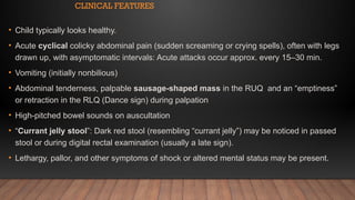Basic on intussusception Pediatrics note | PPT