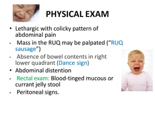 intussusceptIon | PPT