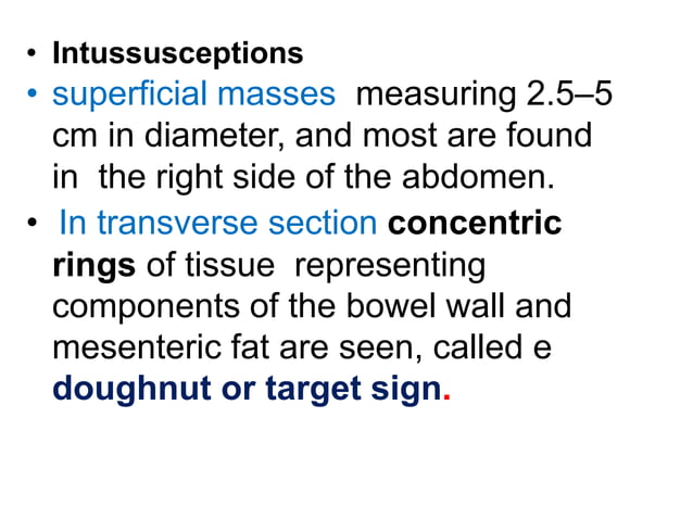 intussusceptIon | PPT