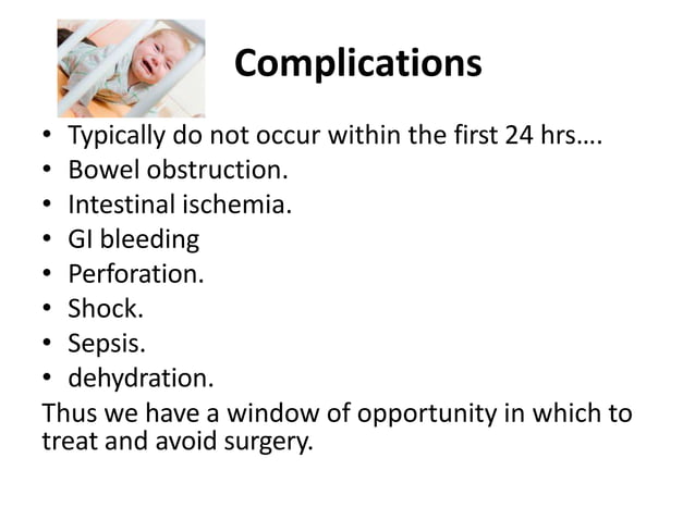 intussusceptIon | PPT
