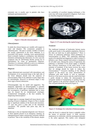 Intussusception in adults | PDF | Digestive Disorders | Diseases and ...