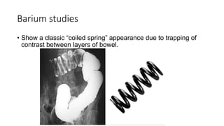 Intussusception in adults | PPTX