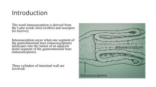 Intussusception in adults | PPTX