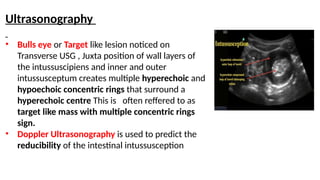 INTUSSUSCEPTION IN CATTLE .pptx