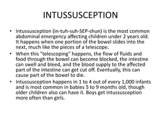 Intussusception | PPTX