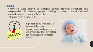 Intussusceptionlecture by Amr Abdellatif.pptx