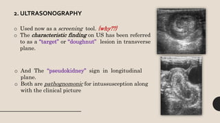 Intussusceptionlecture by Amr Abdellatif.pptx