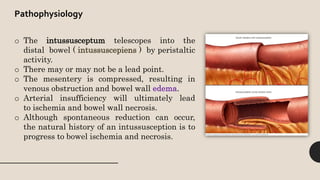 Intussusceptionlecture by Amr Abdellatif.pptx