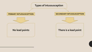 Intussusceptionlecture by Amr Abdellatif.pptx