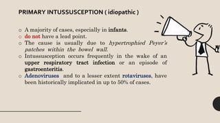 Intussusceptionlecture by Amr Abdellatif.pptx