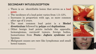 Intussusceptionlecture by Amr Abdellatif.pptx