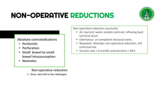 INTUSSUSCEPTION NEW power point fixed presentasion | PPTX | Digestive ...