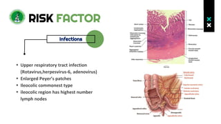 INTUSSUSCEPTION NEW power point fixed presentasion | PPTX