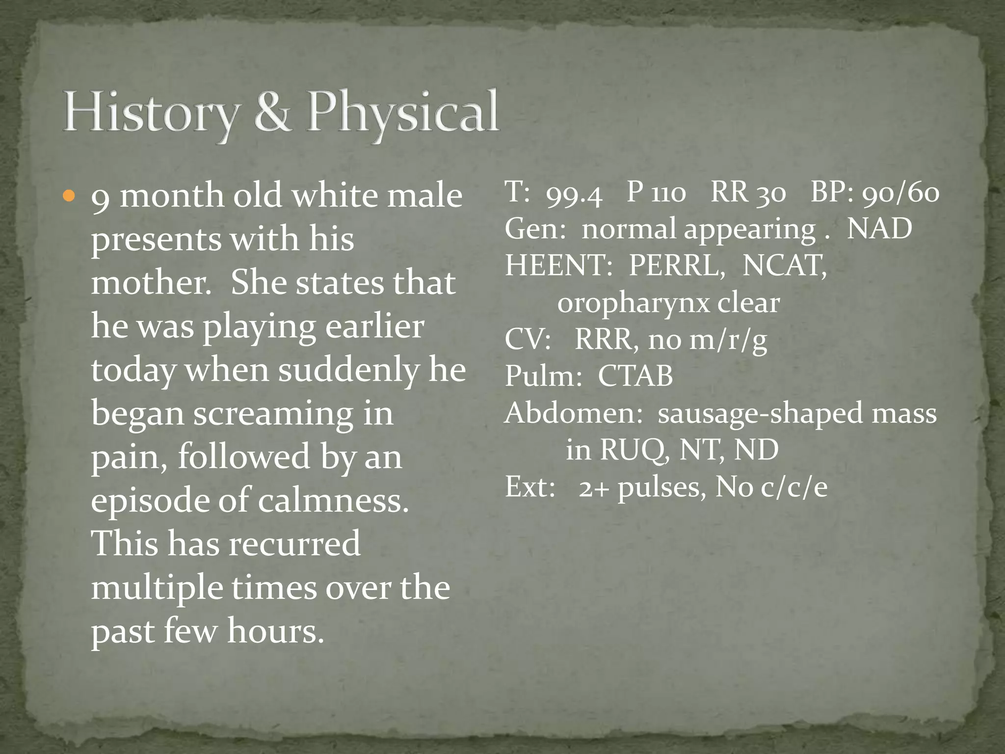Intussusception power point | PPT