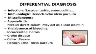 INTUSSUSCEPTION ,MANAGEMENT AND COMPLICATIONS | PPTX