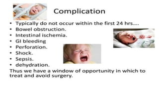 INTUSSUSCEPTION ,MANAGEMENT AND COMPLICATIONS | PPTX