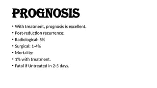 INTUSSUSCEPTION ,MANAGEMENT AND COMPLICATIONS | PPTX