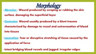 Inury by physical agents | PPT