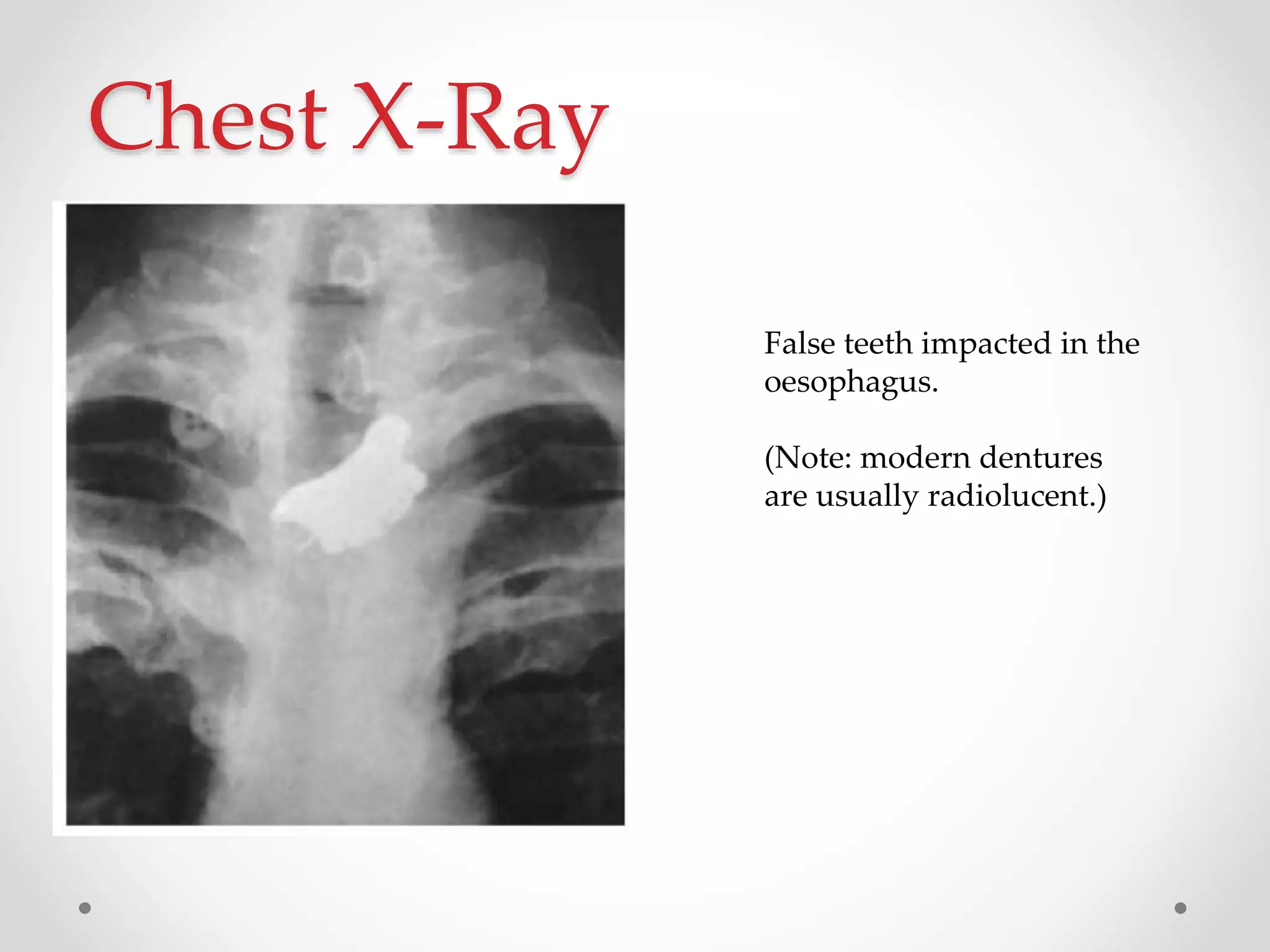 Investigations - esophagus | PPTX
