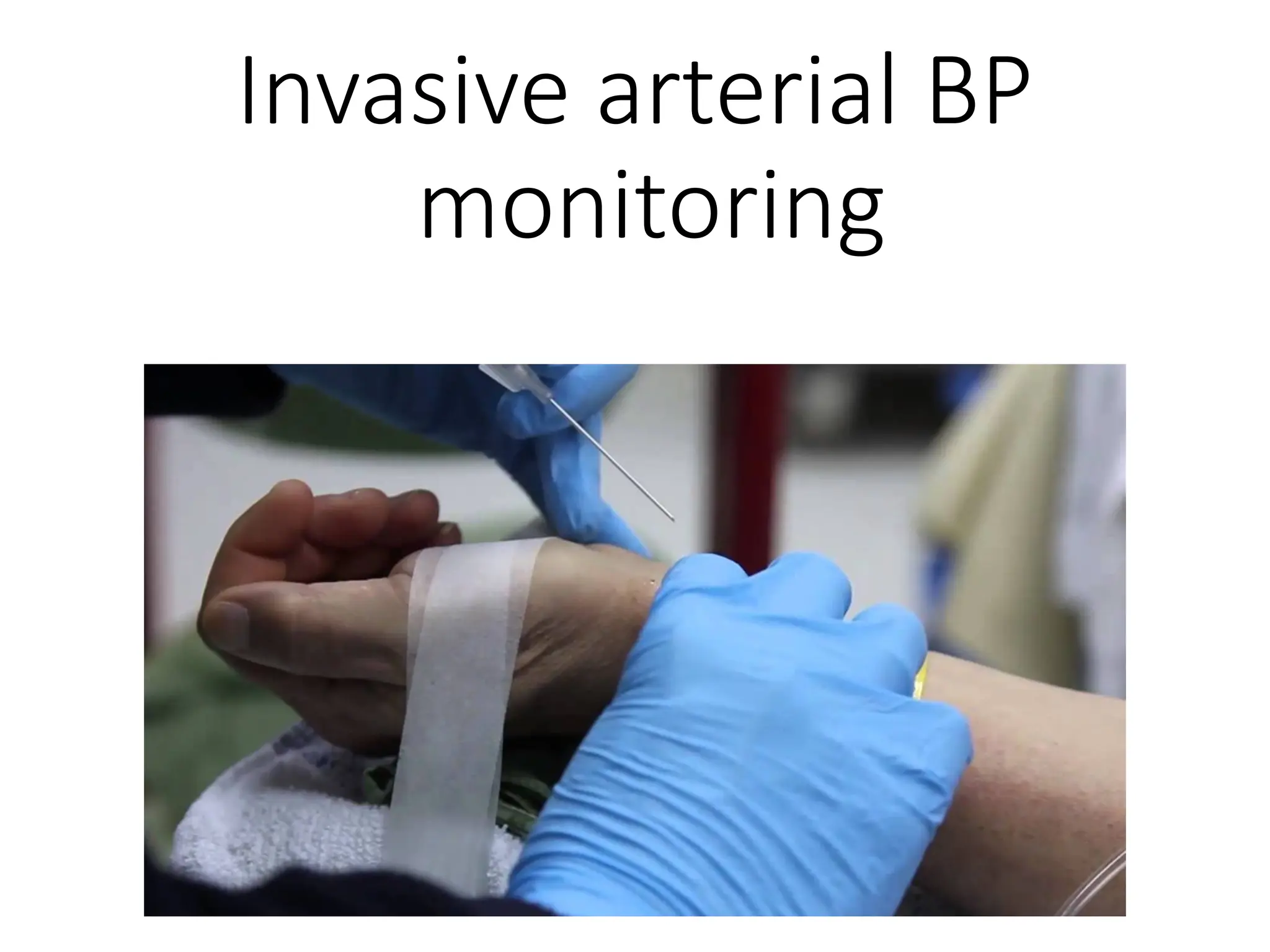 Invasive arterial BP monitoring by Weaam Abdalla | PPT