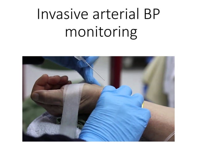 Invasive arterial BP monitoring by Weaam Abdalla | PPT
