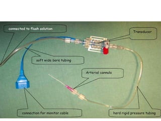 Invasive arterial BP monitoring by Weaam Abdalla | PPT