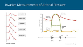 Invasive Blood Pressure: fundamentals and best-practices for ...