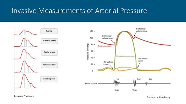 Invasive Blood Pressure: fundamentals and best-practices for preclini…
