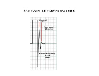 Invasive blood pressure_monitoring | PDF