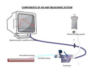 Invasive blood pressure_monitoring | PDF