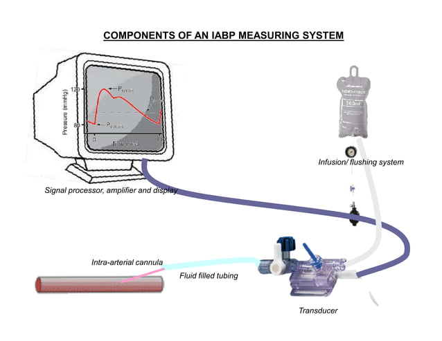 Invasive Blood Pressure monitoring invasive-blood-pressure-monitoring