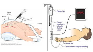INVASIVE BLOOD PRESSURE & NON INVASIVE BLOOD PRESSURE.pptx