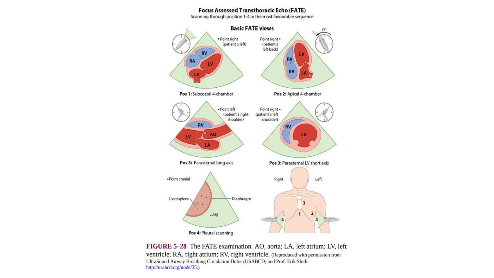 invasivecardiovascularmonitoring-240406064445-593f2963.pptx