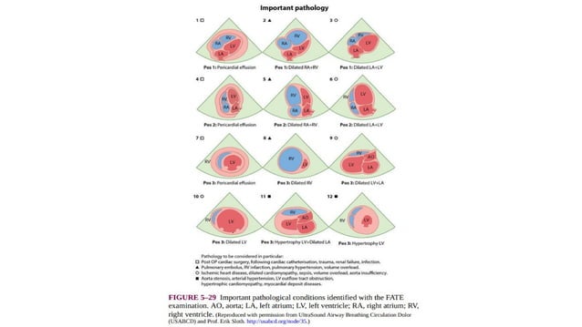 invasivecardiovascularmonitoring-240406064445-593f2963.pptx