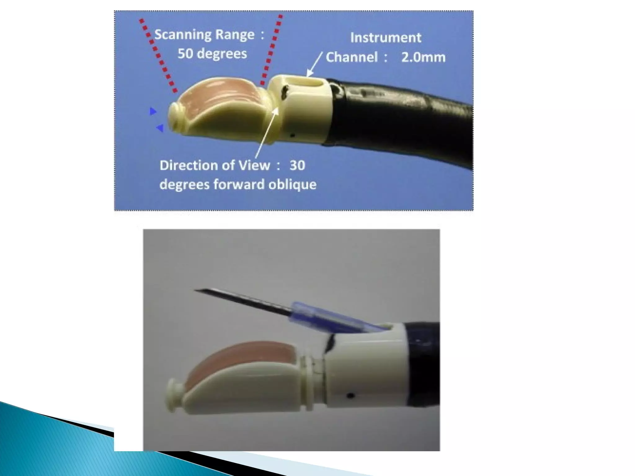 Invasive diagnostic methods of chest, the trachea | PPT