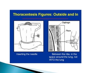 Invasive diagnostic methods of chest, the trachea | PPT