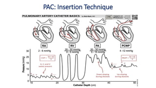 Maximally Invasive Hemodynamic Monitoring | PPT